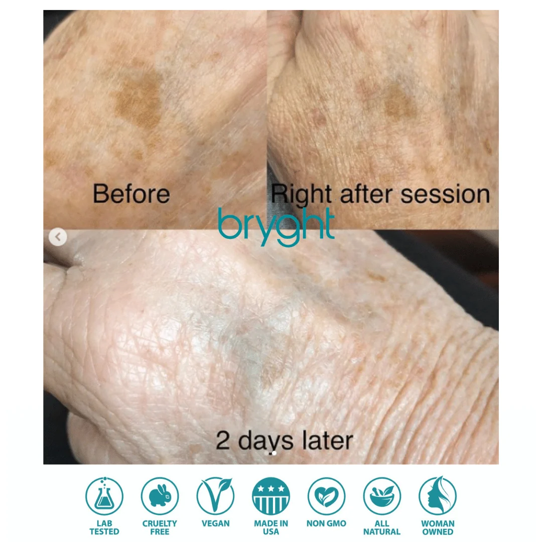 Anal Bleaching Safe and Effective at Bare Fruit Sugaring